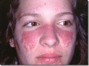 MedSemio: Abril 2012