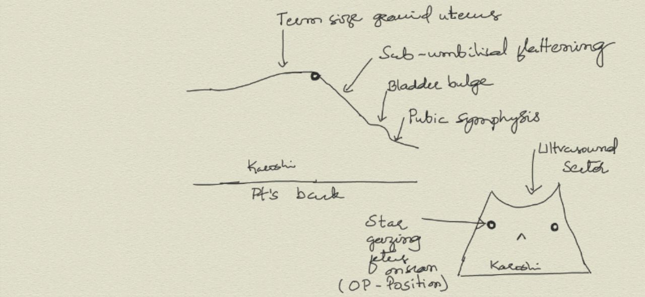 Obstetric experiences: July 2013