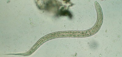 Ancilostomídeos | Biomedicina Padrão