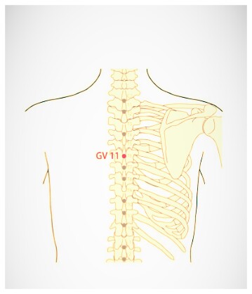 SaroEpic Acupuncture : Acupuncture Points for spinal cord pain
