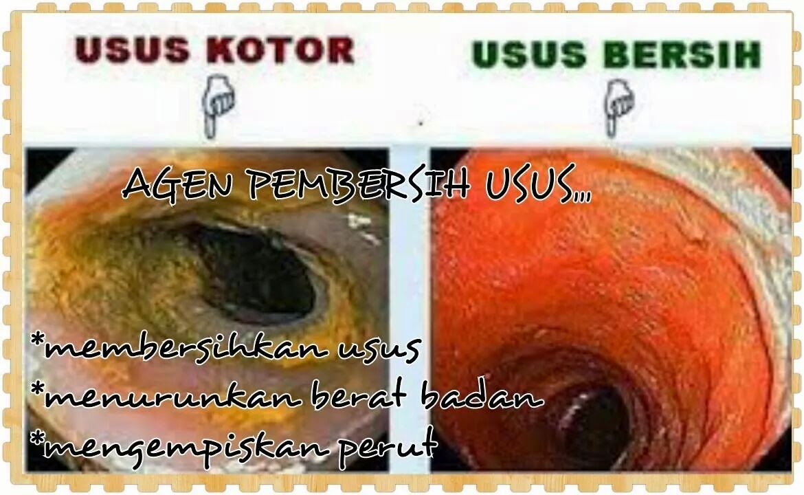 Being Healthy Is A Duty!: 12 TANDA-TANDA USUS ATAU KOLON KOTOR