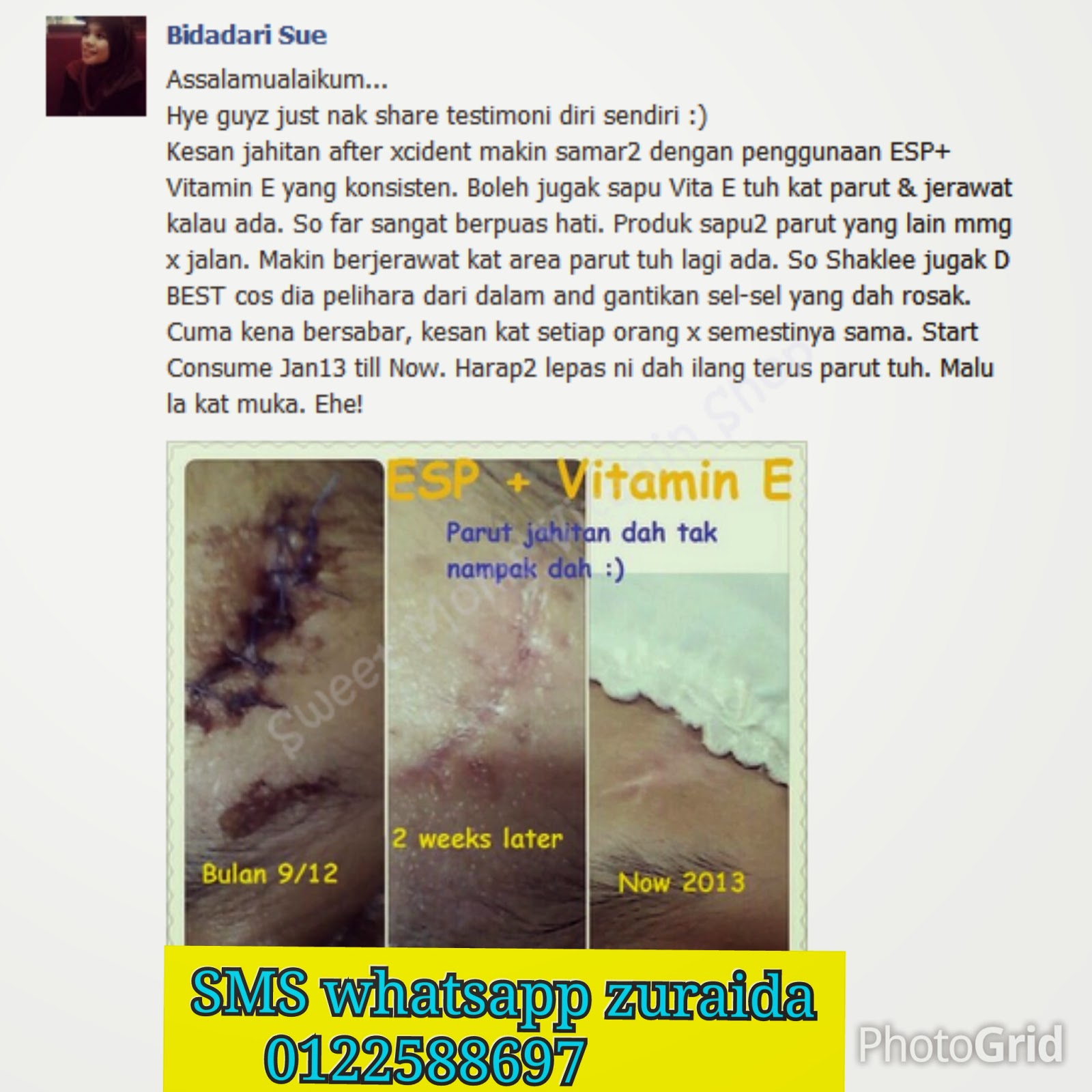 Supplement Store: Supplement untuk hilangkan parut