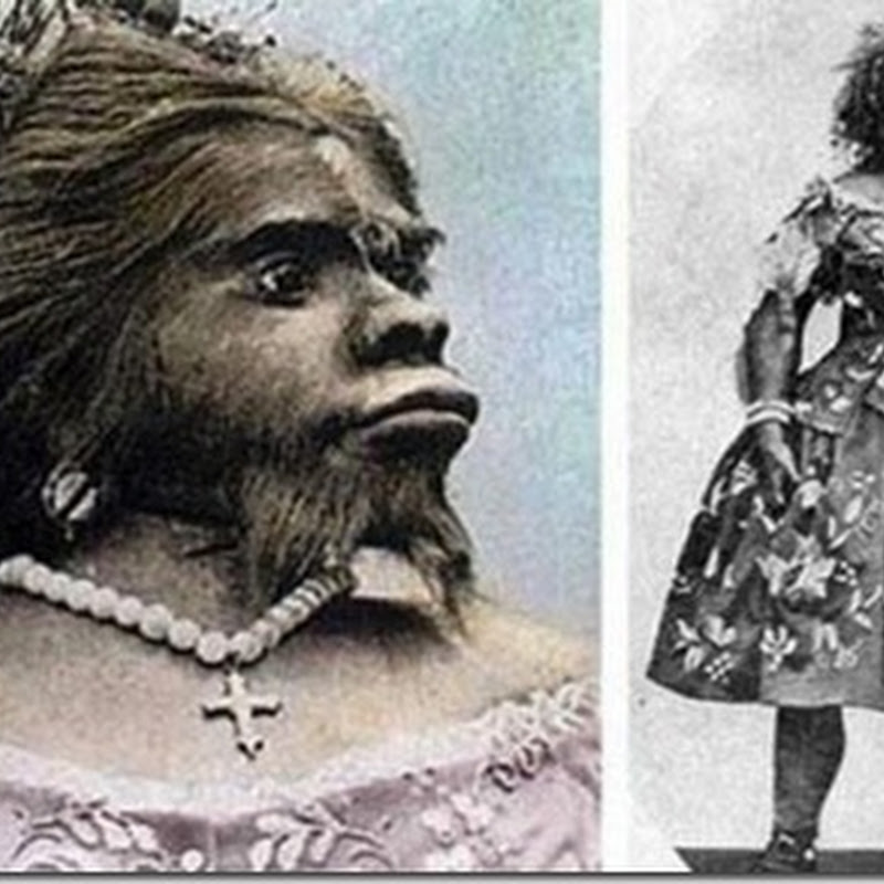 Mexican 'Ape woman' buried after 150 years [Picture]