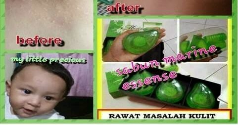 Sihat, Cantik, Hebat: Sabun Marine Essence