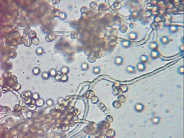Arcyria ferruginea - spores | Project Noah