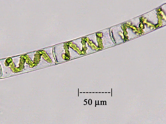 Spirogyra | Project Noah