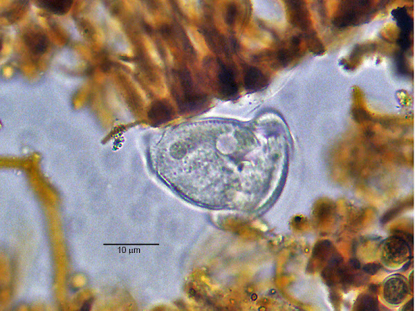 Ciliated protist | Project Noah