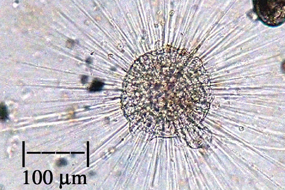 Heliozoan (Sun Animalcule) | Project Noah