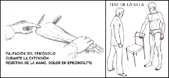 ESPACIO, AMOR Y LOCURA: TENDINITIS DE LA EXTREMIDAD SUPERIOR --IV ...