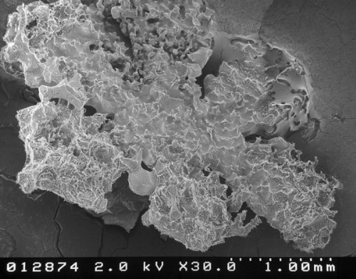 Snow under the electron microscope | Amusing Planet