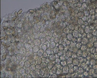 Under the microscope - Scottish Fungi