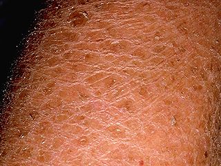 scabrous | Vocabulary