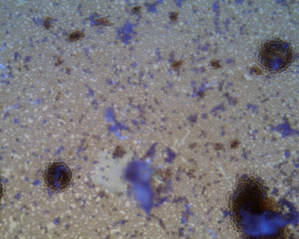 Slime mold magnified | Project Noah