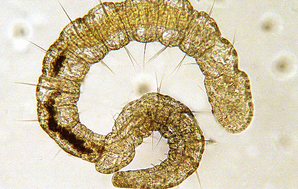 Microscopic Bristle Worm | Project Noah