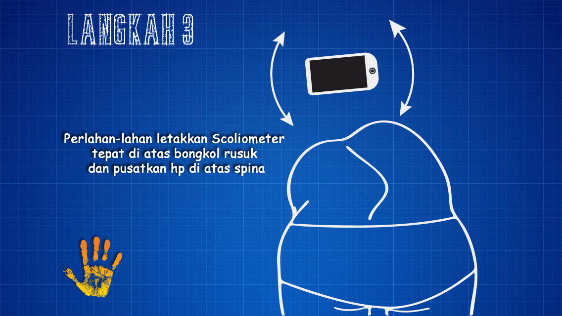 Skoliometer - Apl Android di Google Play