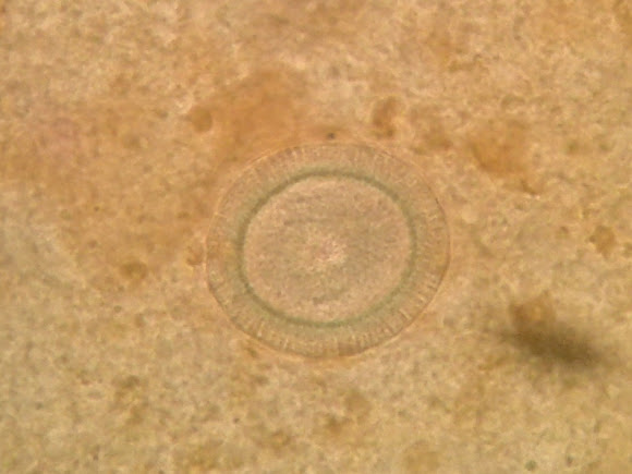 Taenia Solium Egg